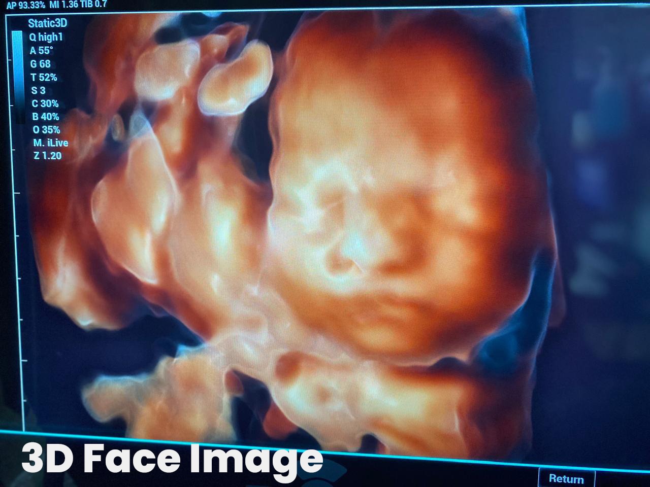Ultrasound Baby 3D / 4D / HD Live Ultrasound Sessions At Bella